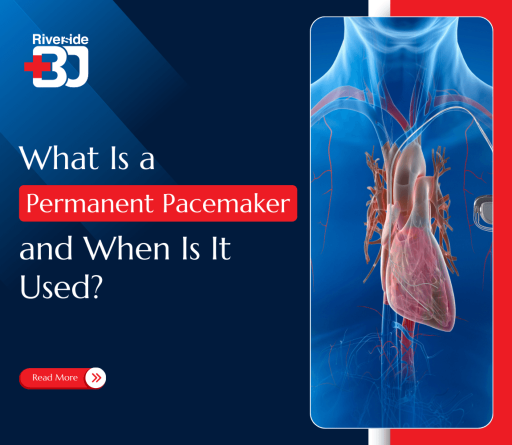 What Is a Permanent Pacemaker, and When Is It Used?