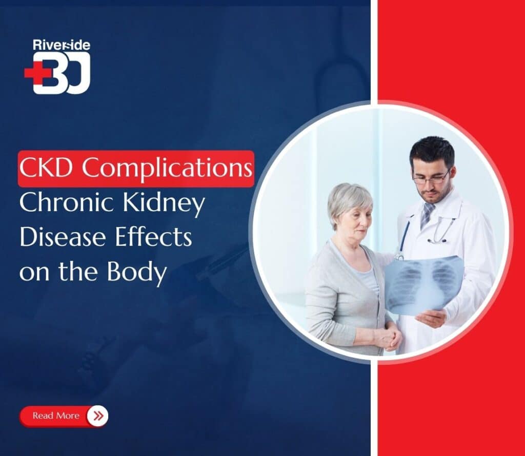 Complications of CKD – Chronic Kidney Disease Risks